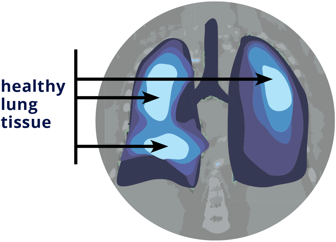 The VITaL Clinical Trial - Image X Institute